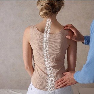 Cervical Kyphosis Treatment: Is Surgery Your Only Option? | Jeremy ...