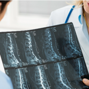 Cervical Kyphosis: Symptoms & Treatment Options - Jeremy Smith, MD